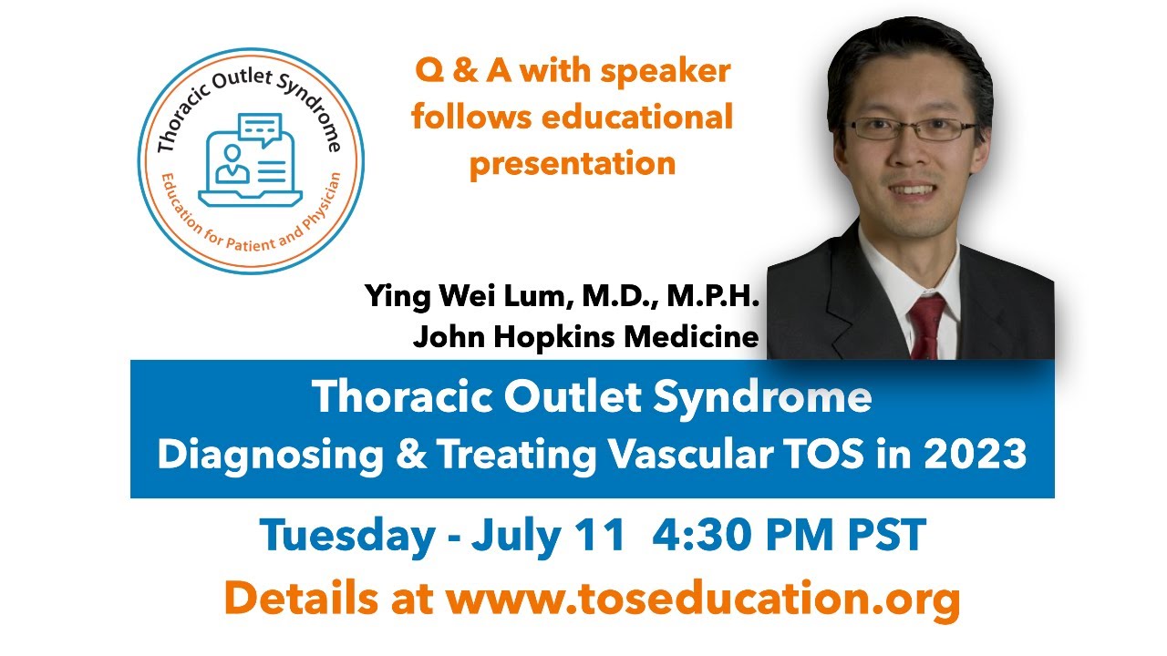 Thoracic Outlet Syndrome: Diagnosing & Treating Vascular TOS in 2023 ...