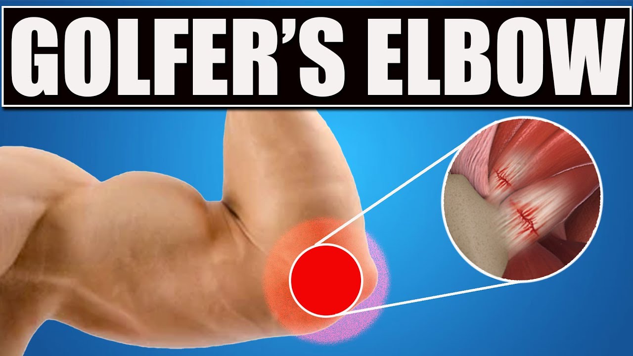 Understanding Golfers Elbow And How To Fix It – Sfostsee