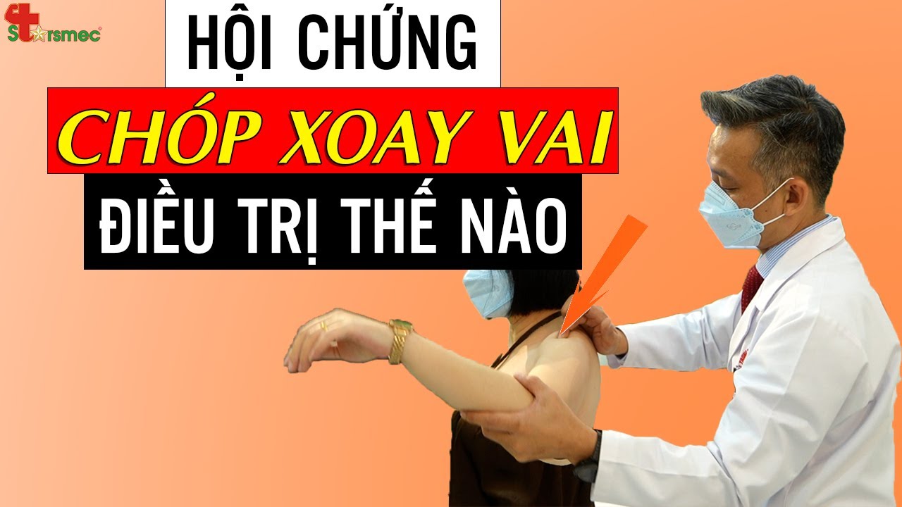 Hội chứng Chóp xoay vai - Điều trị thế nào? | Y học Thể thao Starsmec ...