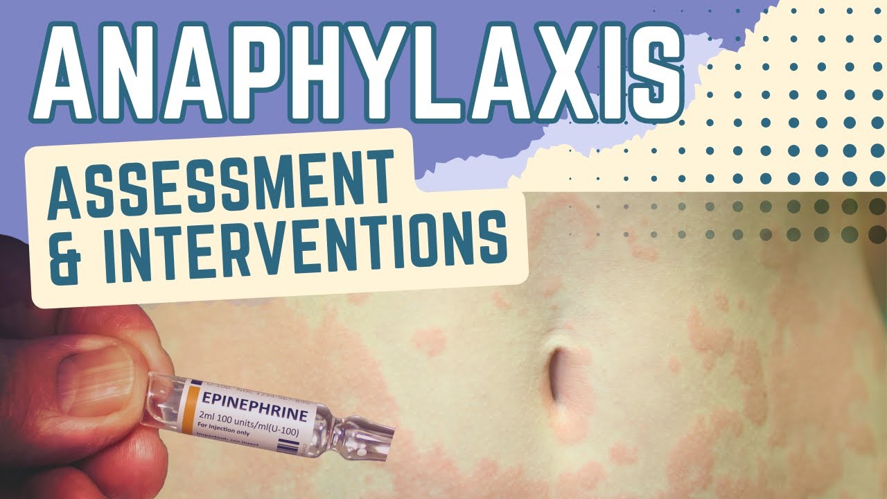 Anaphylaxis- Assessment and Interventions- Nursing - YouTube