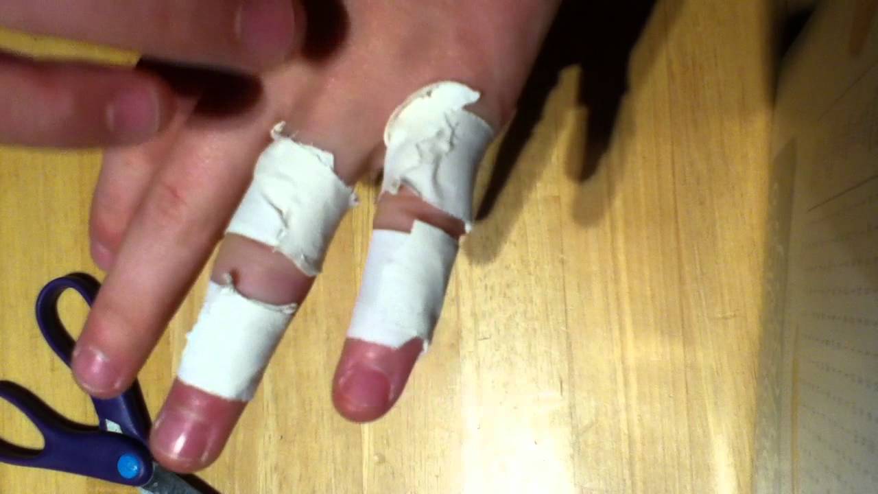 Foulure au doigt - YouTube