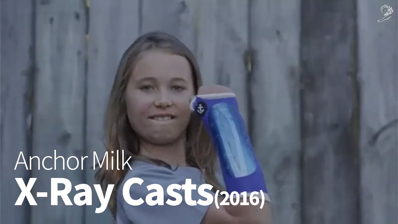 Anchor milk(앵커 우유) - X Ray Casts(엑스레이 캐스트) - YouTube