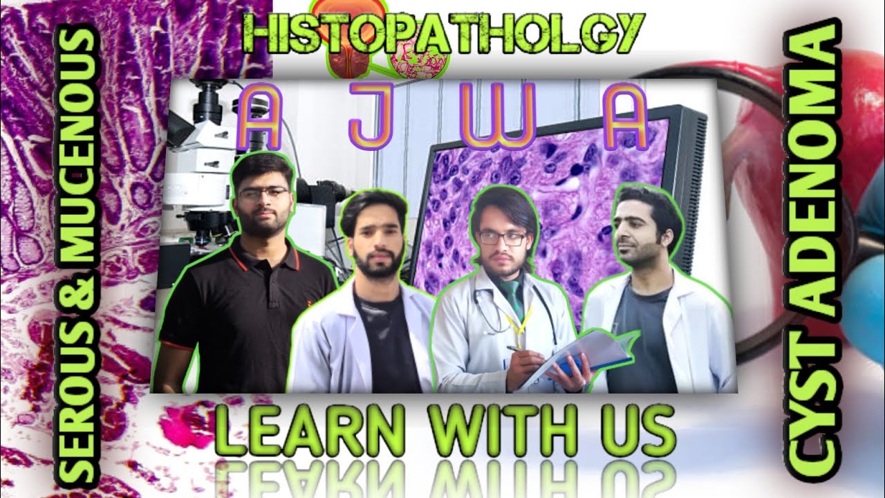 SEROUS & MUCINOUS CYST ADENOMA |HISTOPATHOLOGY MADE EASY| MBBS - YouTube