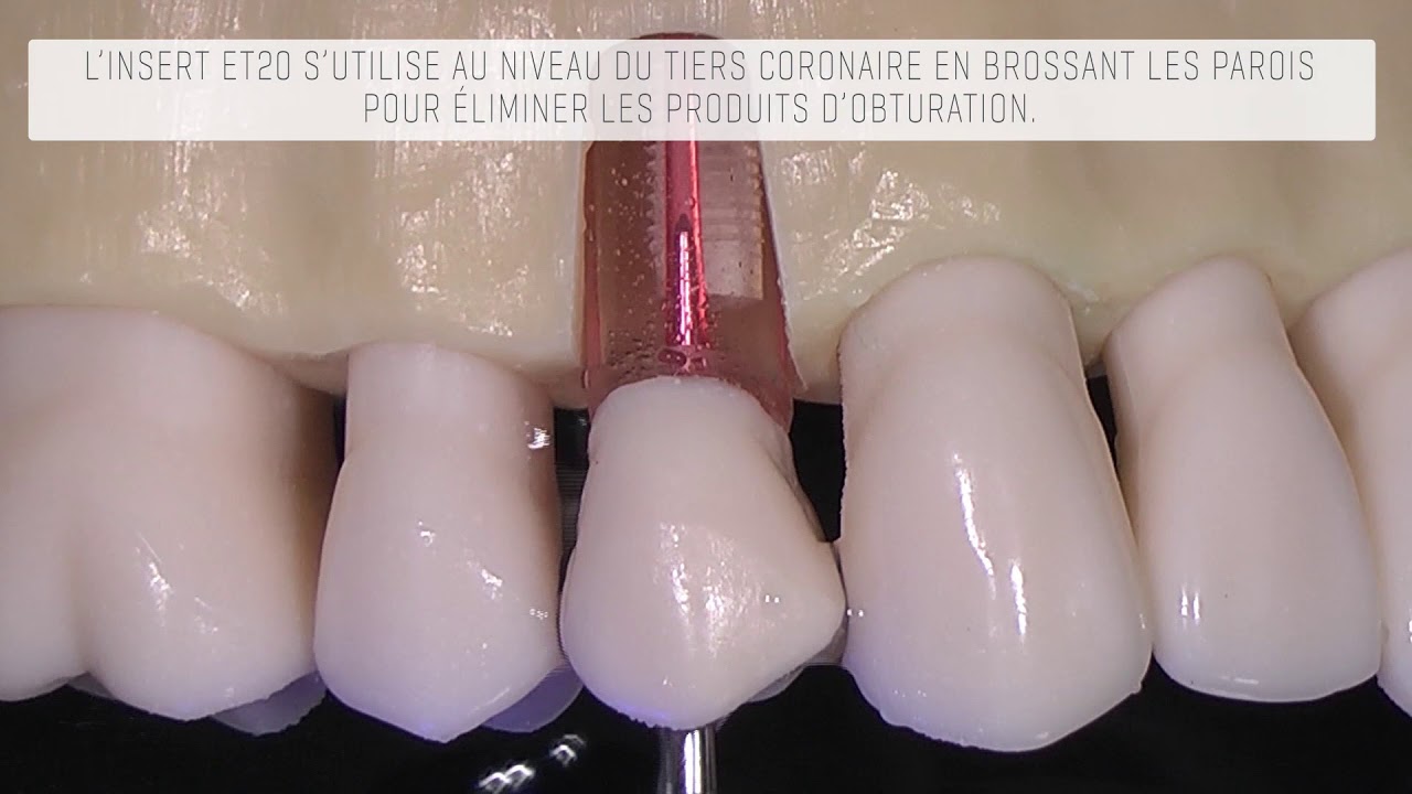 PRESENTATION Inserts Endodontie – Equipement – Acteon - YouTube