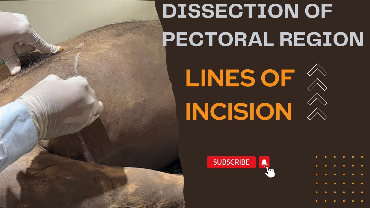 INCISION LINES of Pectoral region on CADAVER - YouTube