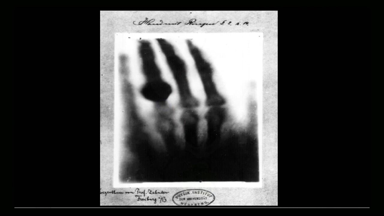 Imaging humans: Sumir S. Patel, MD at TEDxTelfairStreet - YouTube