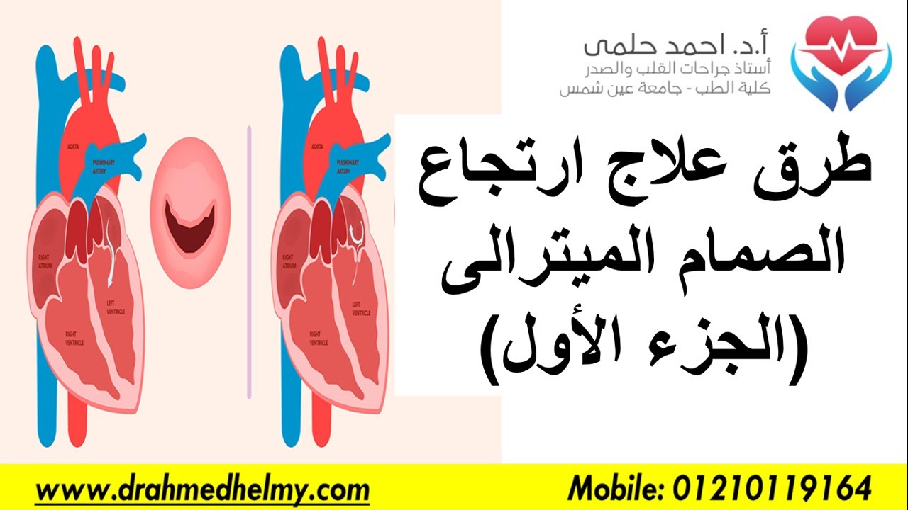 علاج ارتجاع الصمام الميترالى الجزء الأول علاج الارتجاع البسيط والمتوسط Youtube
