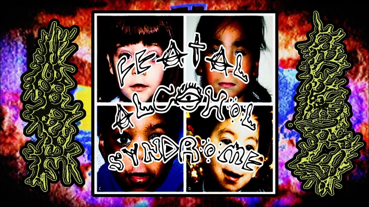 FETAL ALCOHOL SYNDROME - MEGA SCOLIOSIS - YouTube