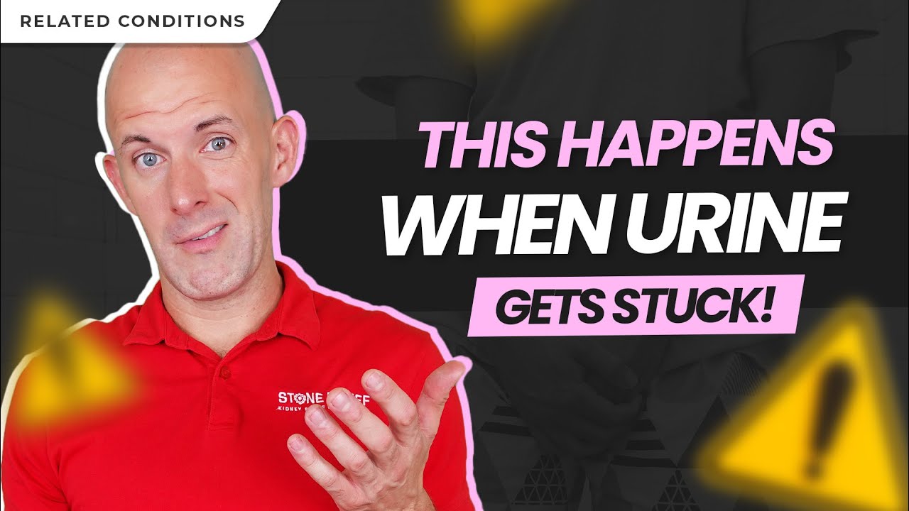 Hydronephrosis Explained: Kidney Swelling, Blockage & Treatment Options ...