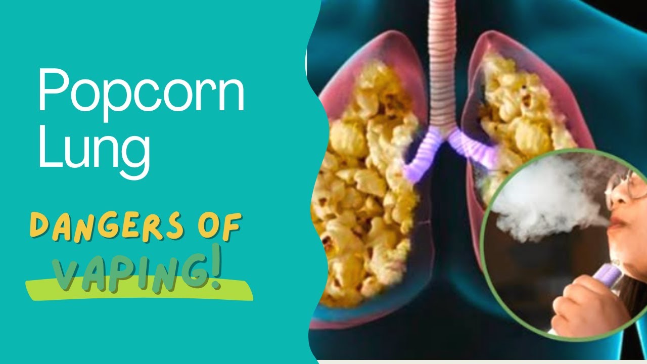 Popcorn lung - YouTube