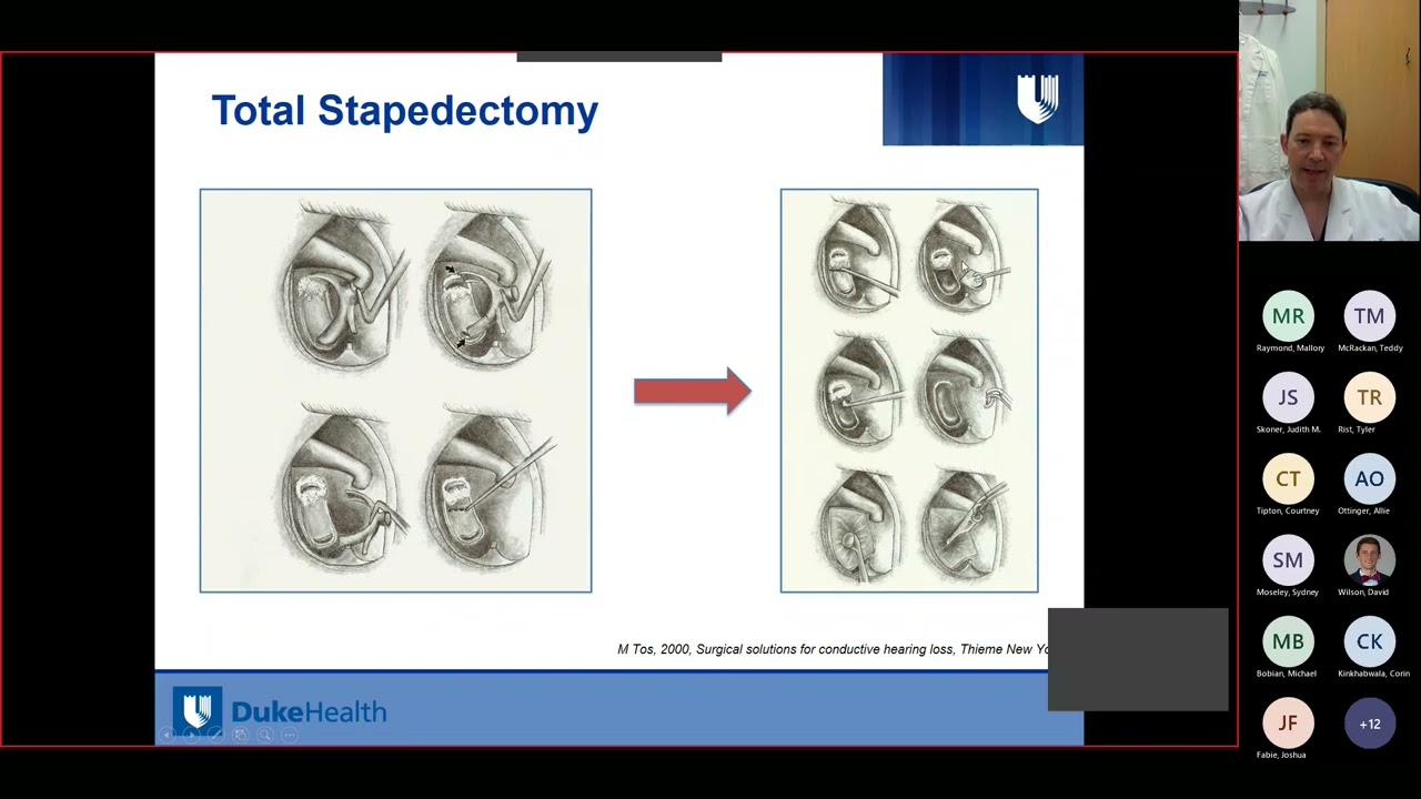 Current Trends in Stapes Surgery - Dr. Calhoun Cunningham, MD - Duke ...