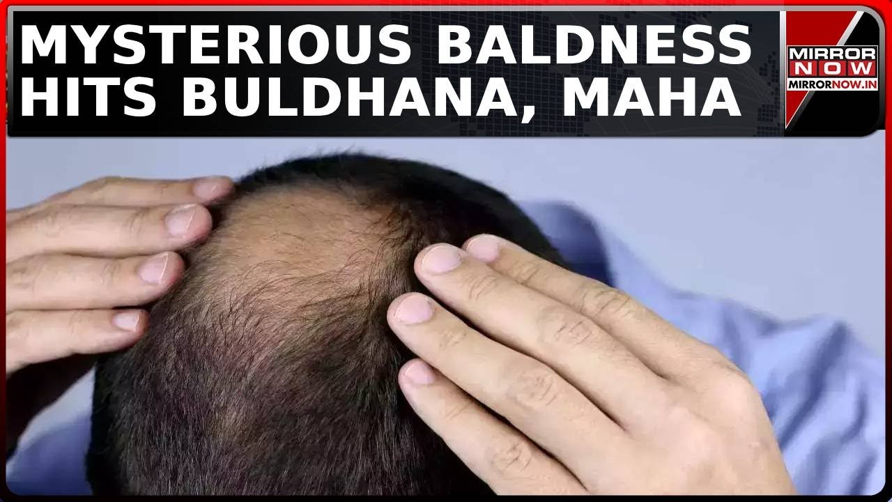 Maharashtra | Toxic Wheat Behind Sudden Baldness In Buldhana District ...
