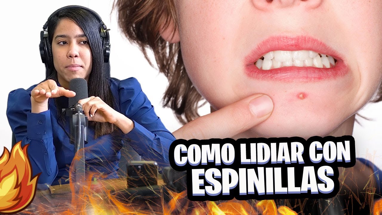 La verdad detrás de las espinillas: estrés, manchas y consejos pa’ que ...