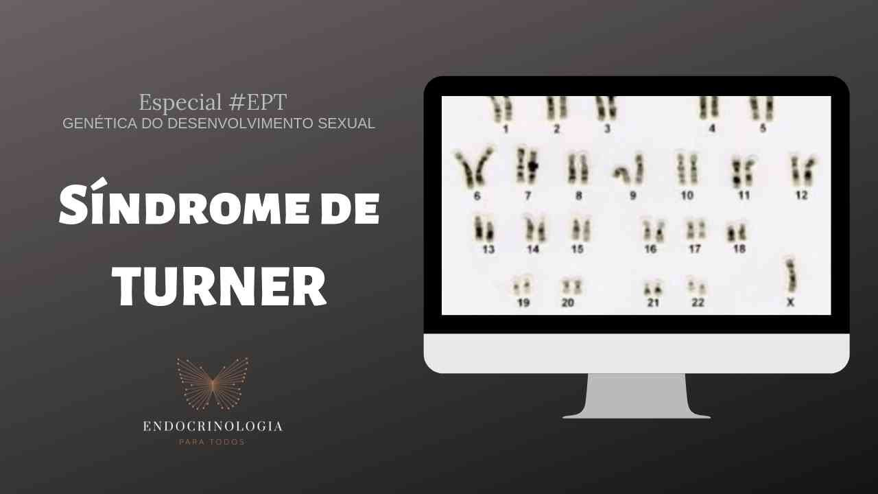 O que é a Sindrome de Turner? - YouTube