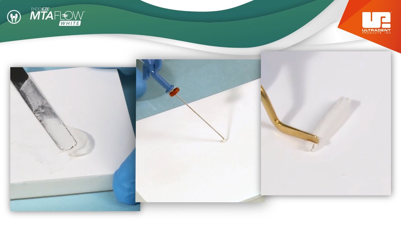 MTAFlow Repair Cement – Available in Non-Staining White - YouTube