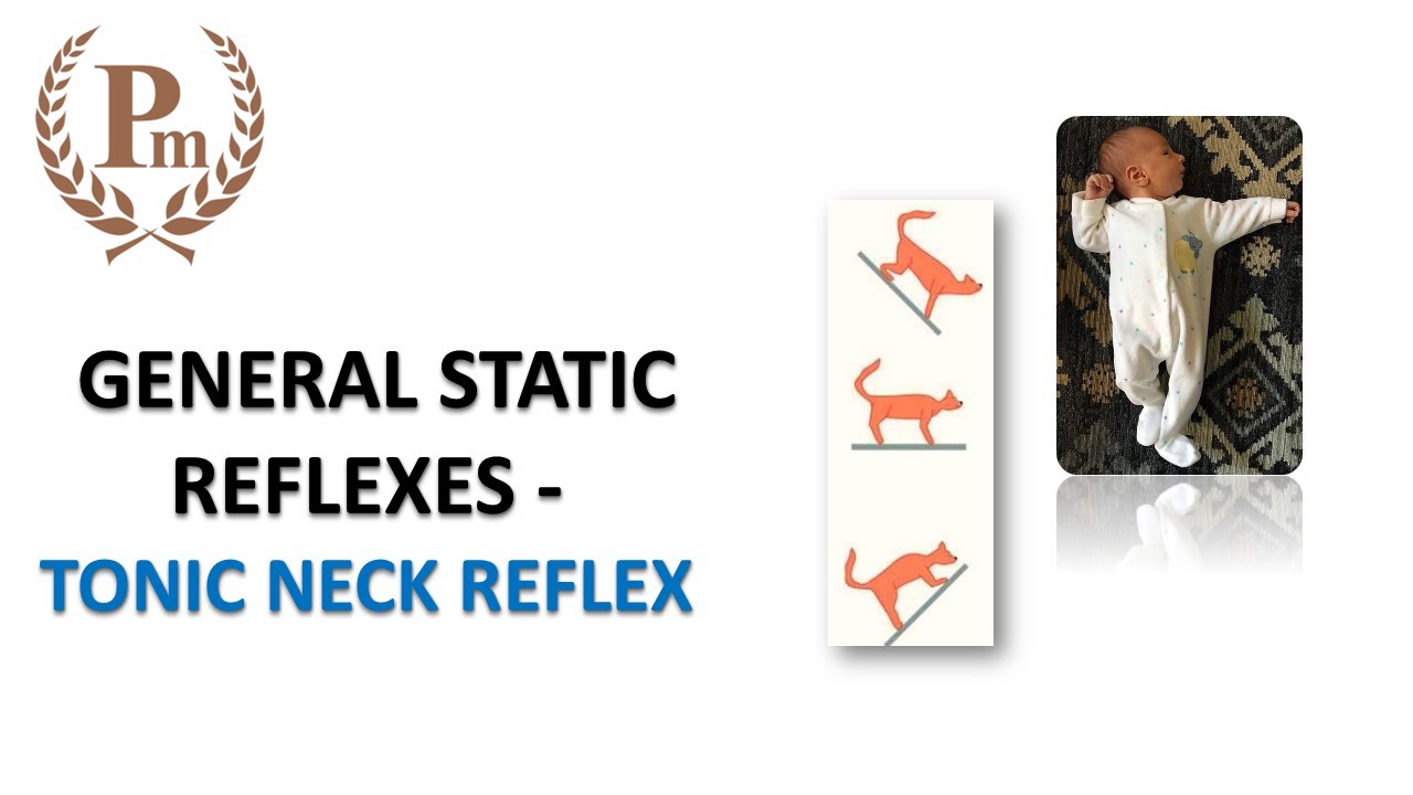 General static reflex - Tonic Neck Reflex - YouTube
