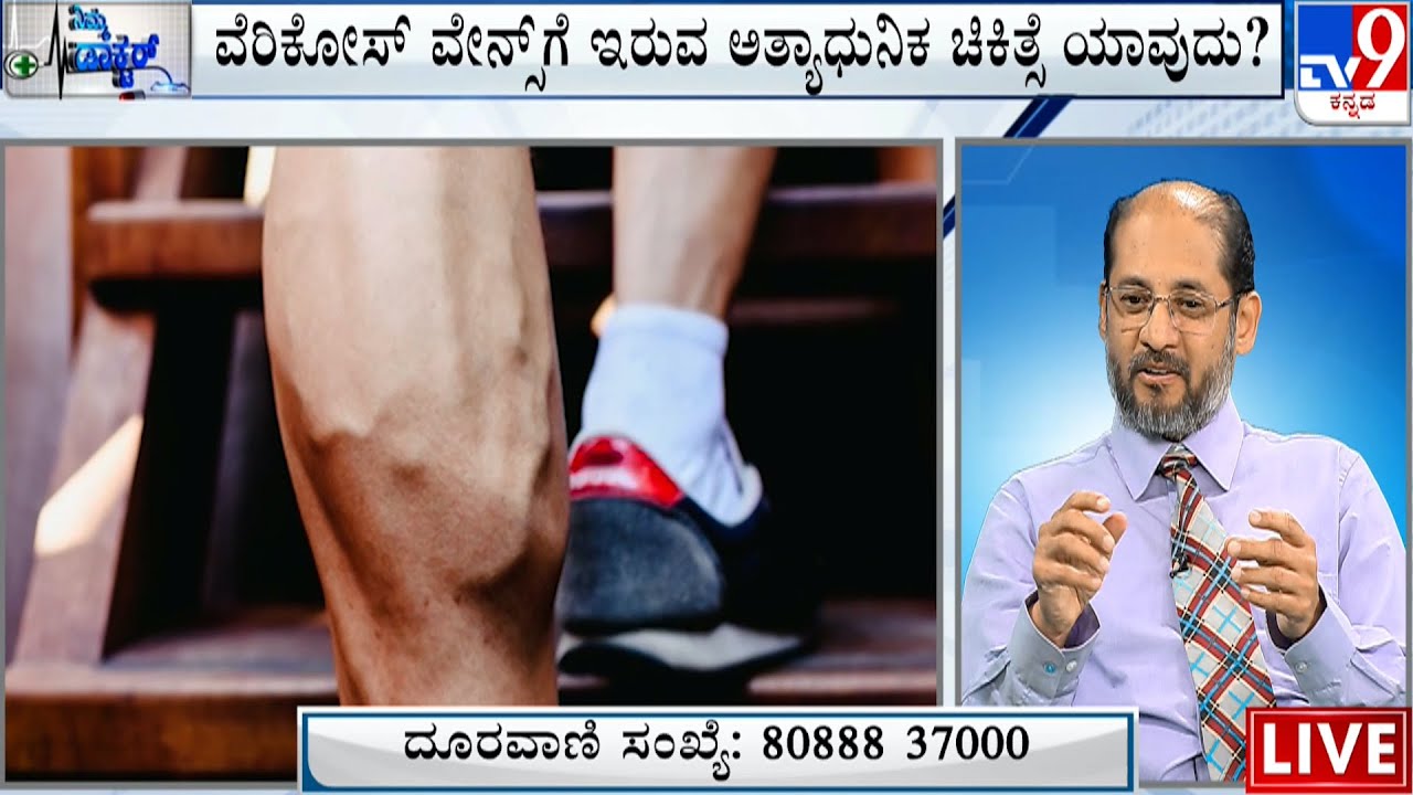 Nimma Doctor | Treatment For Varicose Veins | AVIS Hospital(19-09 -2022 ...