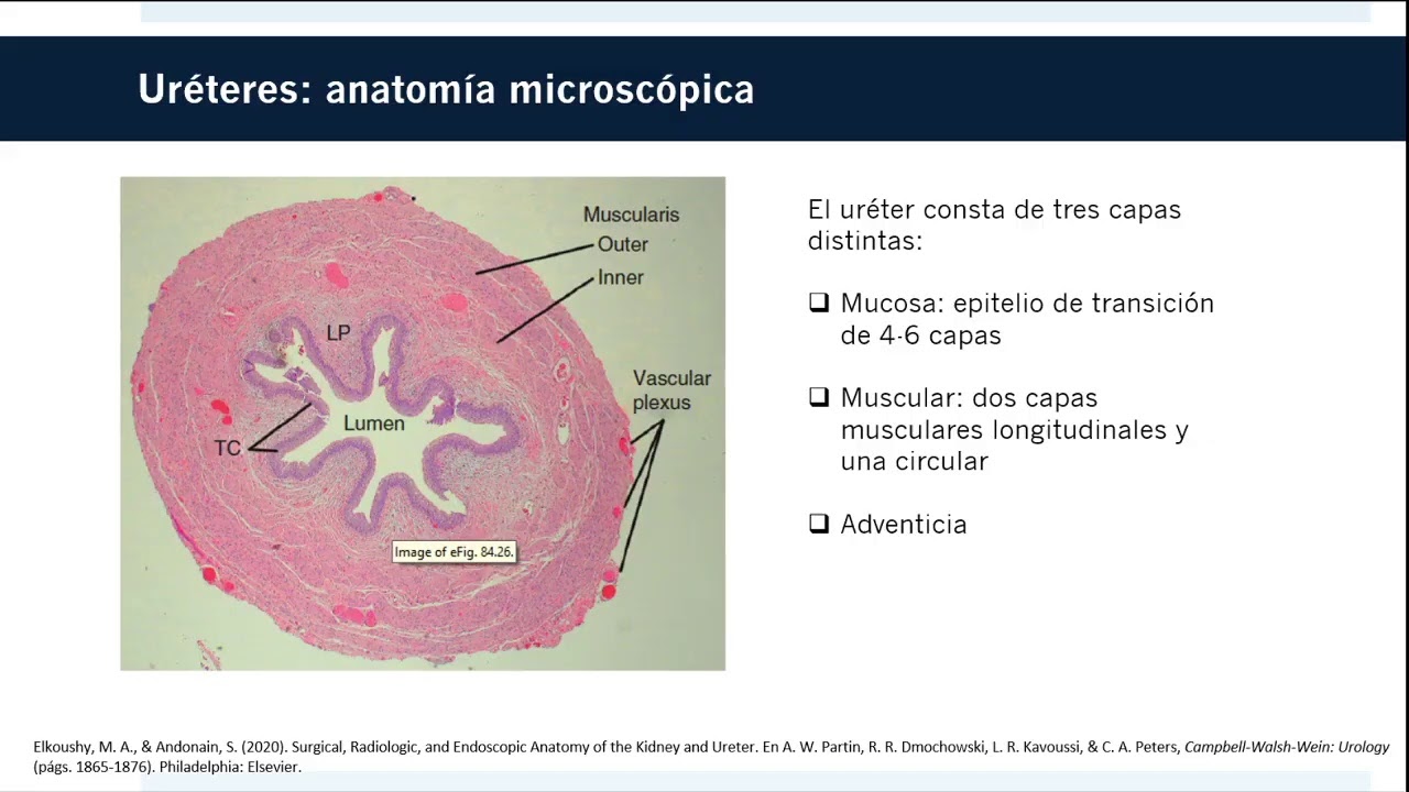 Sesión académica: Anatomía quirúrgica de riñón y uréter - YouTube
