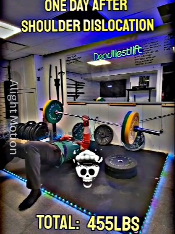 One Day After Shoulder Trollface 💀 #short #ytshort #troll - YouTube