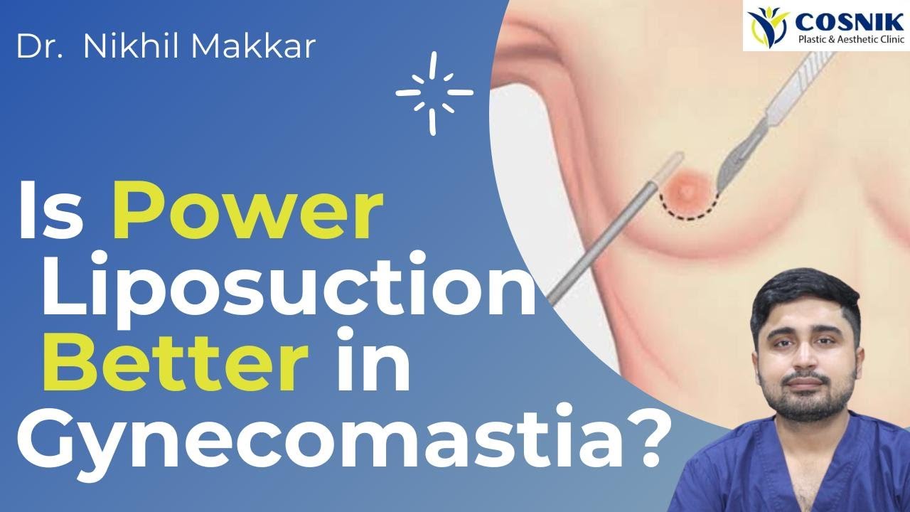 Normal Liposuction vs Power Liposuction for Gynecomastia | Dr. Nikhil Makkar | Cosnik Clinic ...