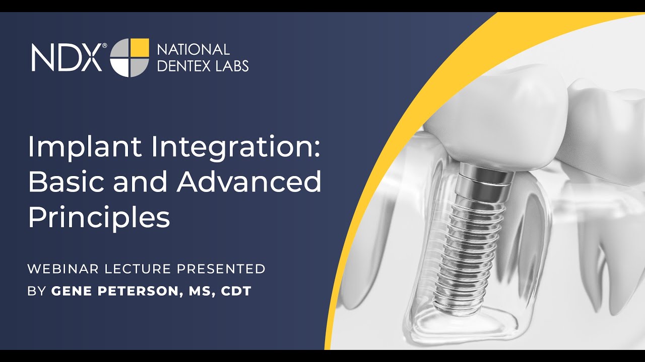 Implant Integration: Basic and Advanced Principles - YouTube