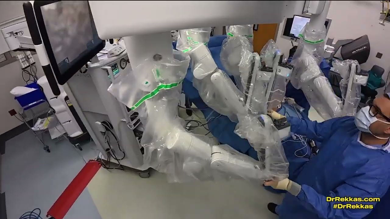 Endolumik Narrated Robotic Sleeve Gastric Sleeve Surgery Surgeon's POV ...