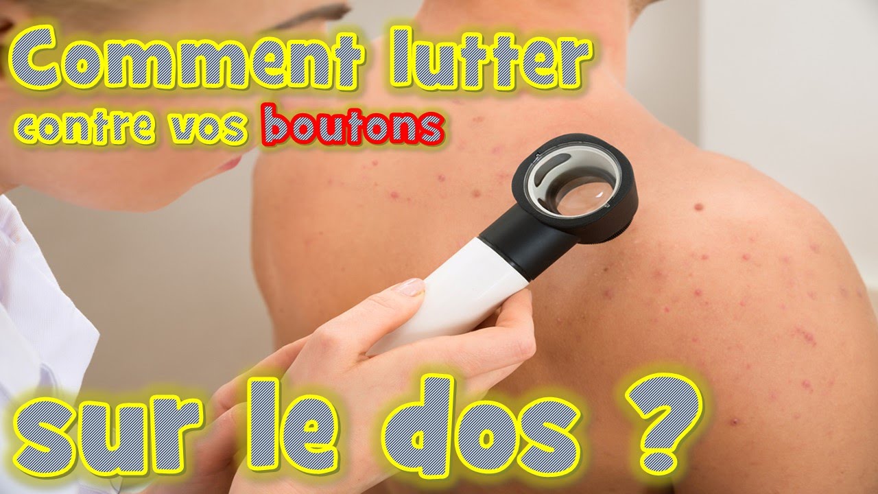 bouton d'acné : Comment lutter naturellement contre vos boutons sur le ...