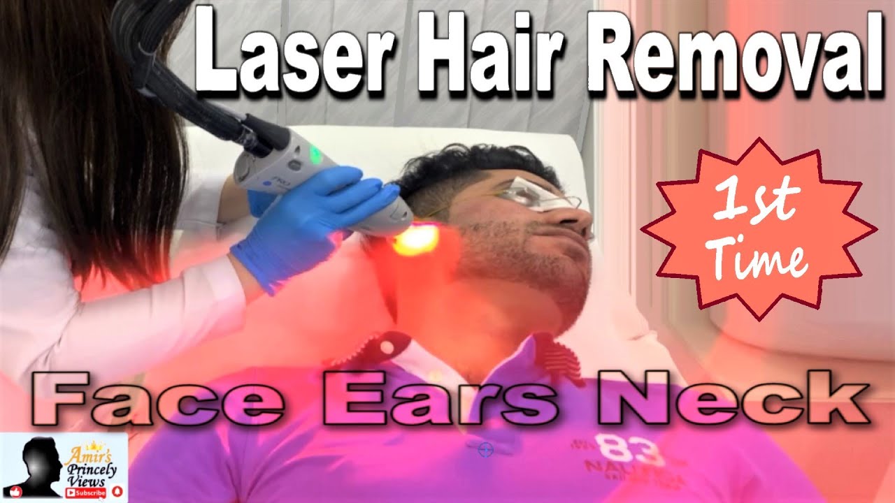 1st Time Laser Hair Removal Experience | Face Ears & Neck Treatments ...