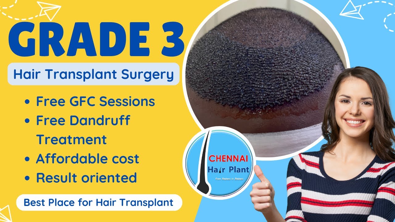 👍Best Place for Hair Transplant - Surgery Cost starting from 25K to 45K only - Result oriented ...