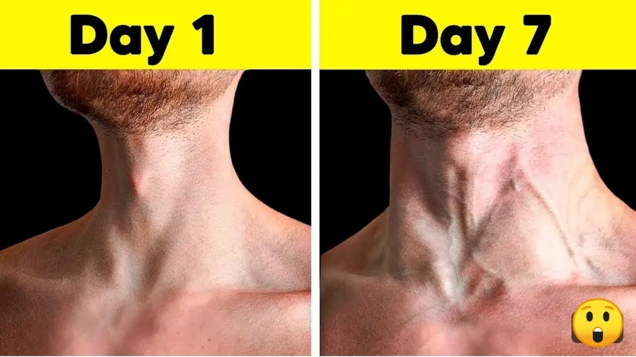 How To Built A Strong Neck In 7Days l Best Exercise Gain Neck Muscle ...