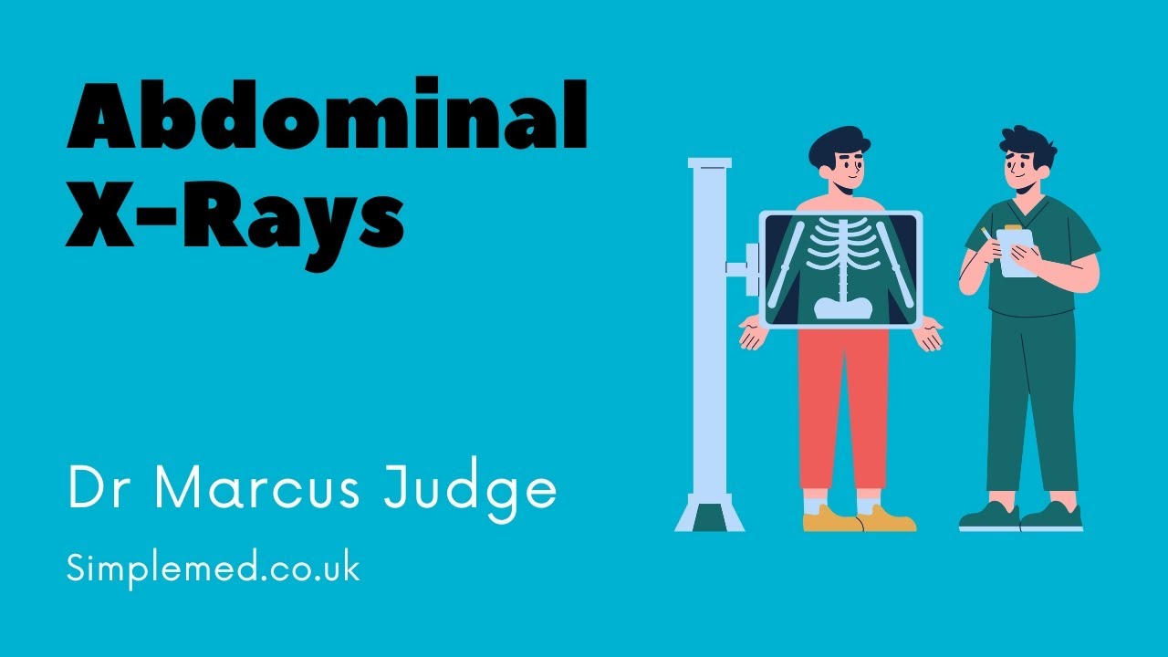 Abdominal X-Rays | SimpleMed Radiology Lecture Series | Dr Judge - YouTube