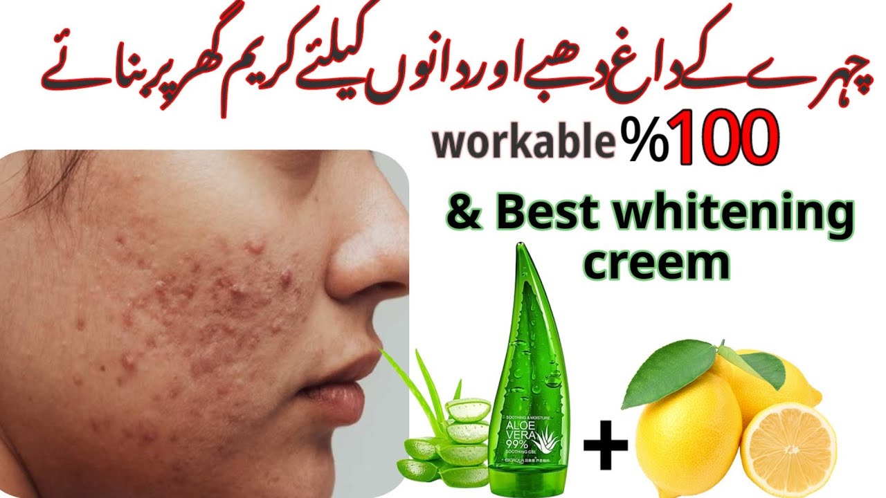 How to make pimples removal cream at home | Best cream for pimples ...