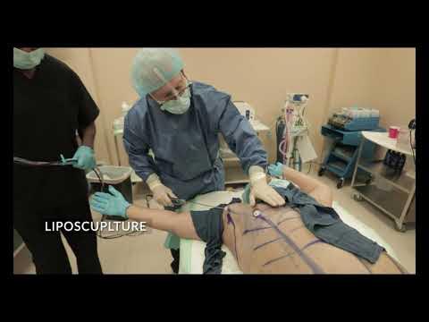 LEBO GYNO & BEYOND TOUCH UP SURGERY NEW YORK MALE 26 HI-DEF VASER, "6-PACK ABS" LIPO - YouTube