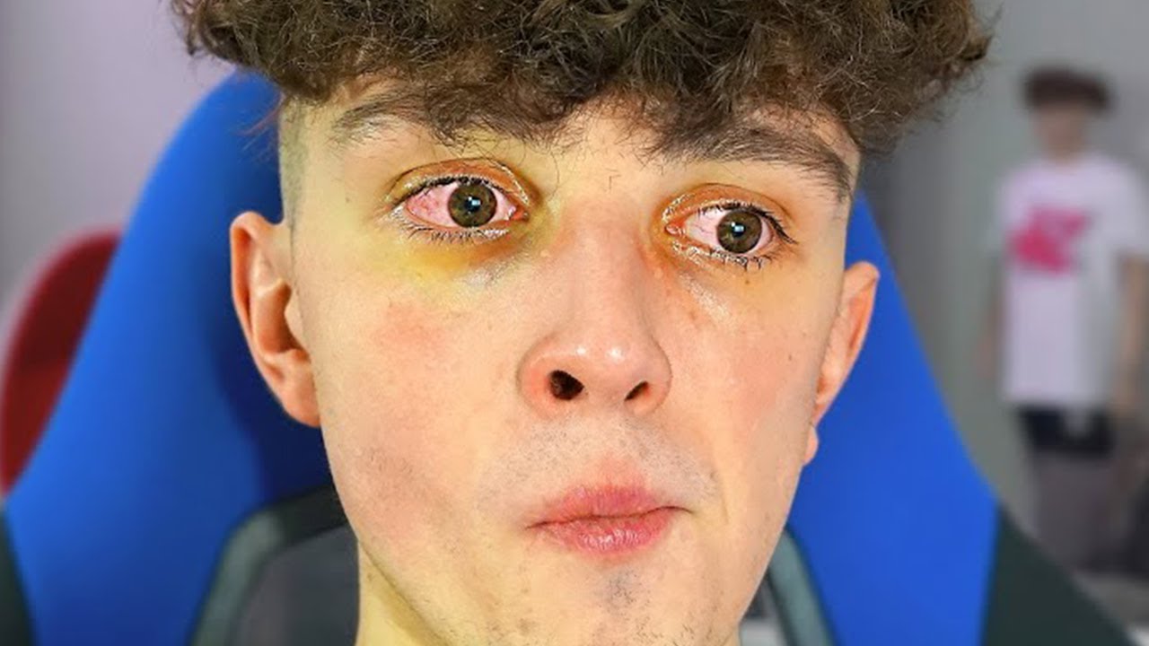 What Happened To Morgz? - YouTube