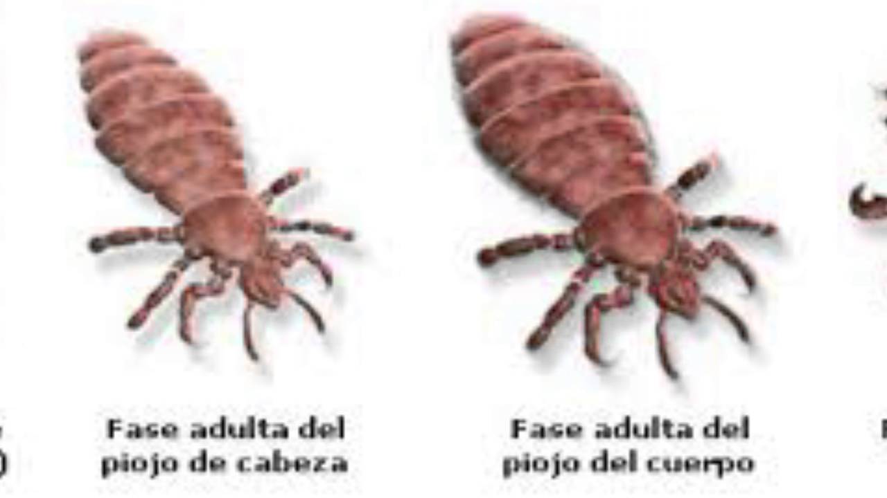 LA ENFERMEDAD DE LAS LADILLAS - YouTube