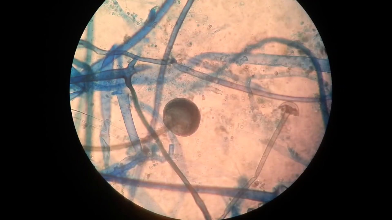 Rhizopus Under Compound Microscope