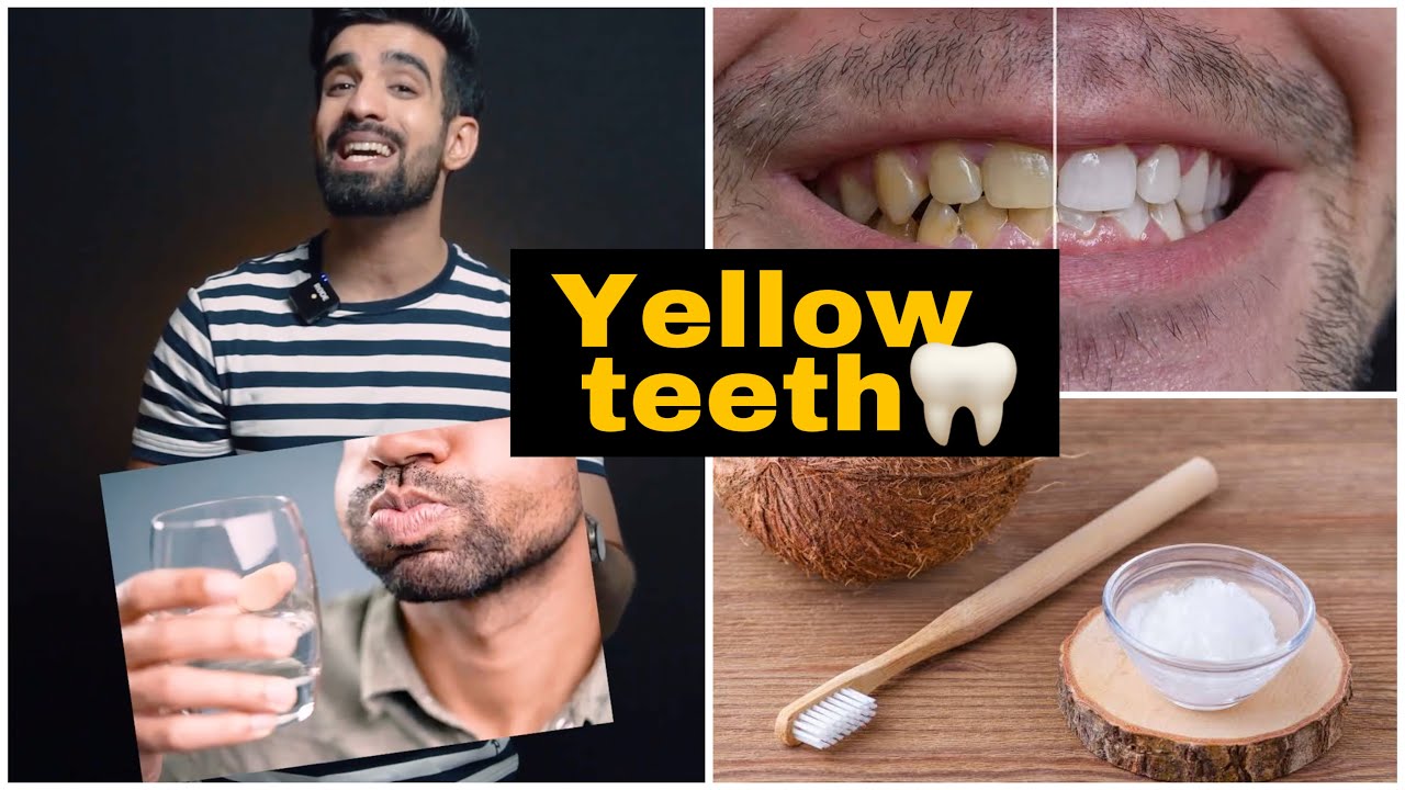 Yellow Teeth Cure *Natural*🦷🥥 #shorts #yellowteeth - YouTube