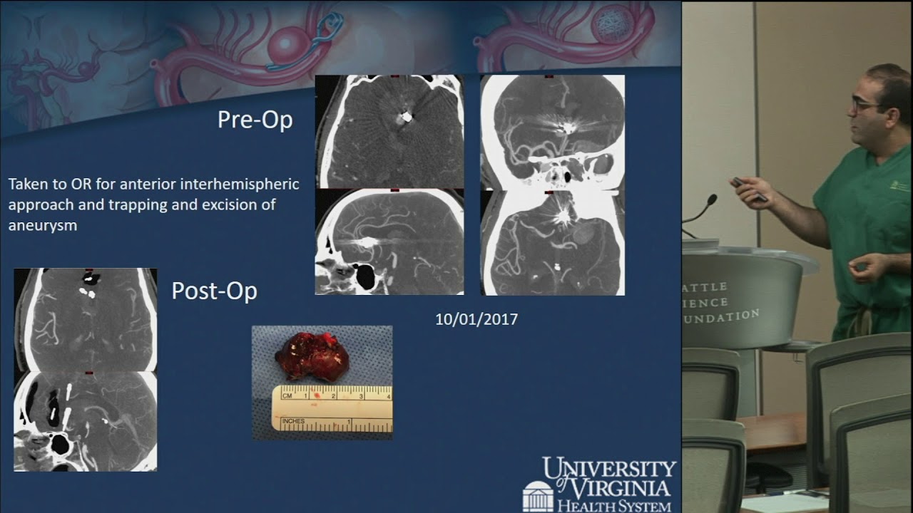 Aneurysms: Salvage Treatment of Complex Open and Endovascular Cases ...
