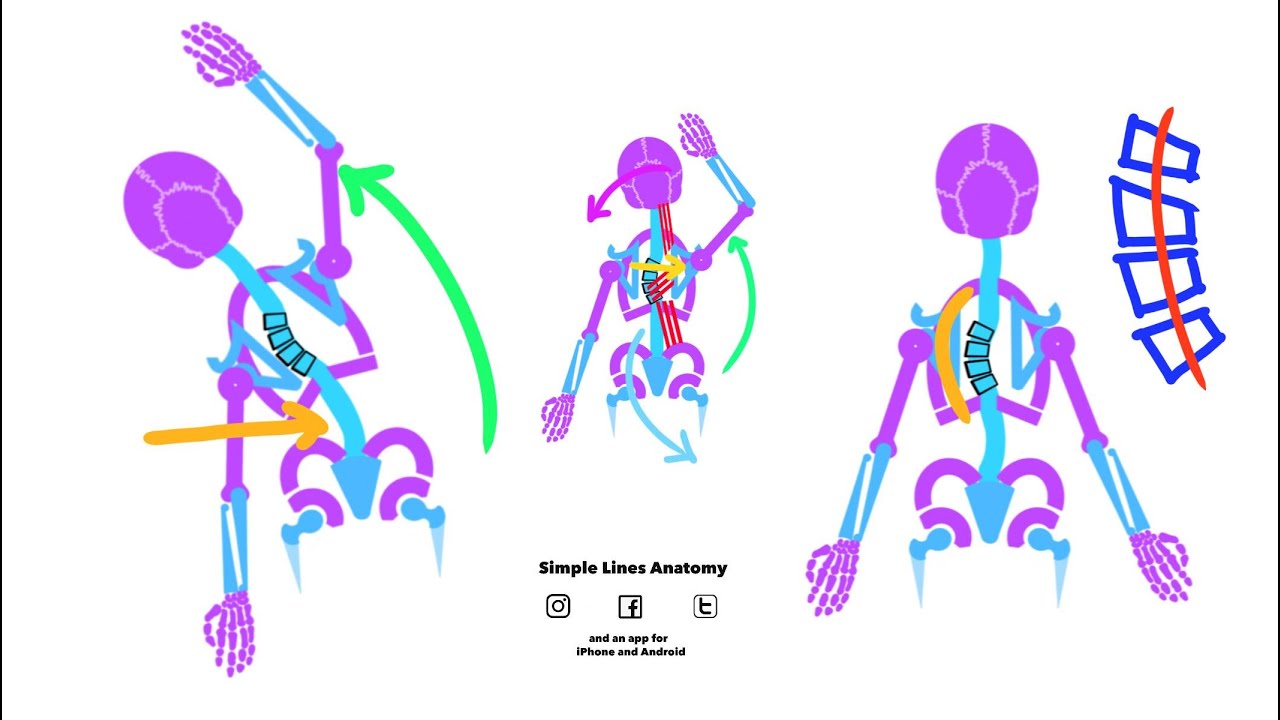 Scoliosis and Whole Body Compensation - YouTube