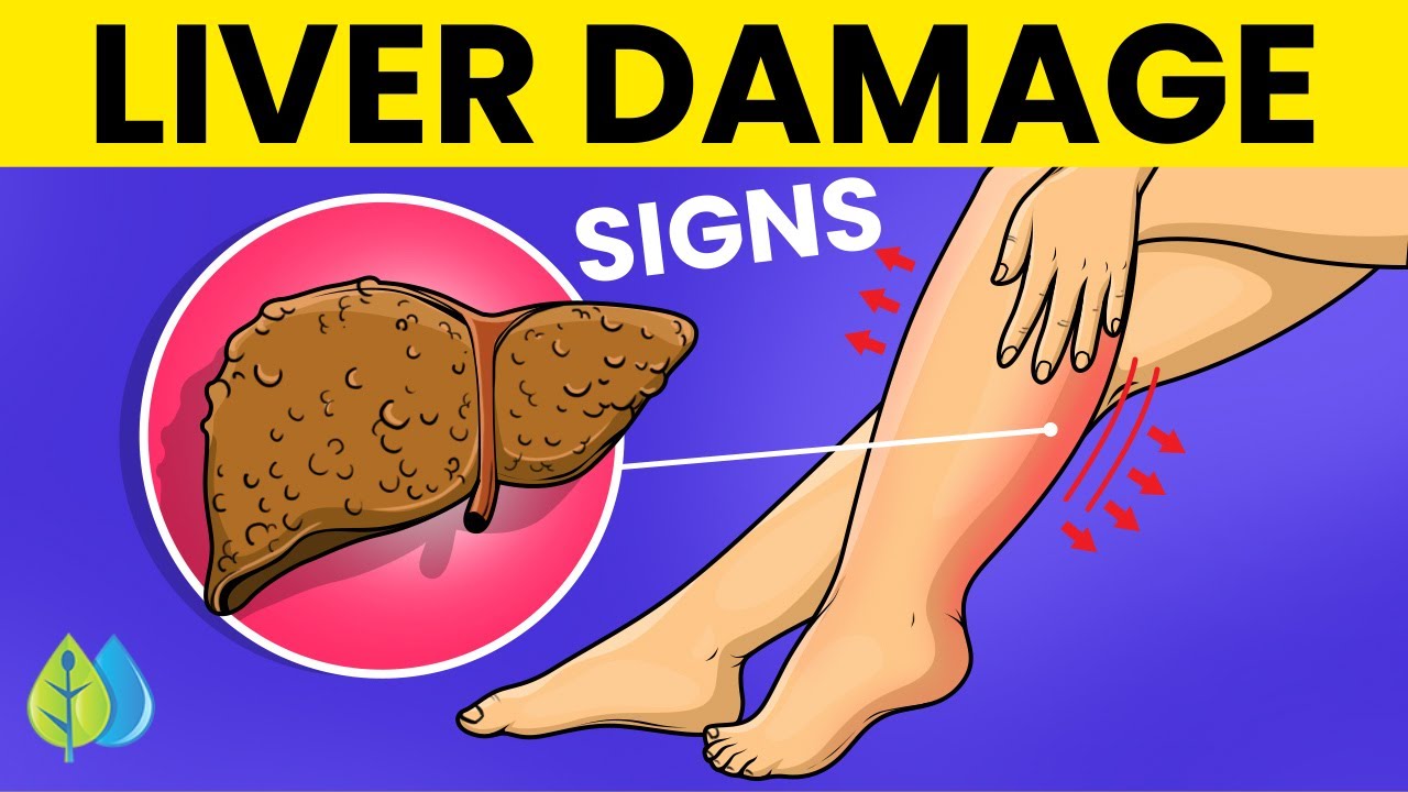 Symptoms of Liver Damage: Top 14 Signs of Liver Disease You Need To ...