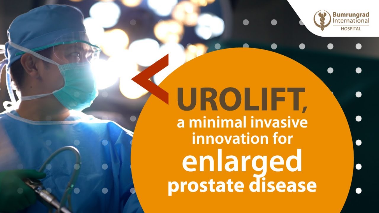 UROLIFT, a minimal invasive innovation for enlarged prostate disease ...