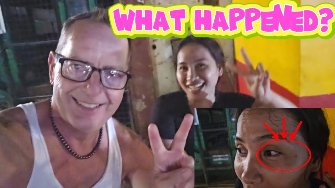 What happened to te.Perla's eye? - YouTube