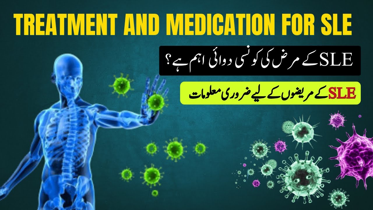 Treatment and medication for SLE | Dr.NaseemArshad | Rheumatologist ...