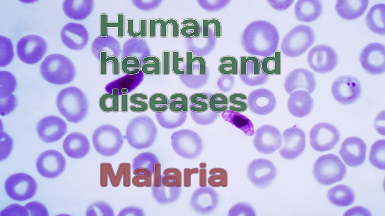 malaria disease in human health and diseases easy short notes - YouTube