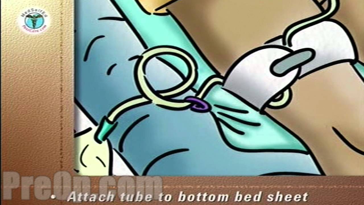 Discharge Closed Urinary Drainage System PostCare™ Patient Education HD ...