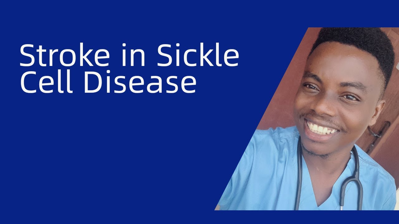 Stroke in Sickle cell disease - YouTube