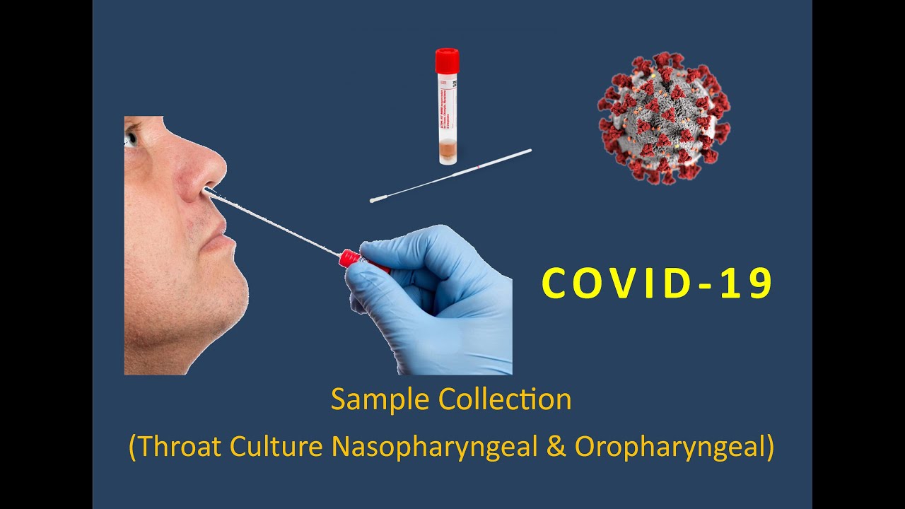 जानिए कैसे लेते हैं स्वाब सैंपल | How to Collect Swab Sample | COVID-19 ...