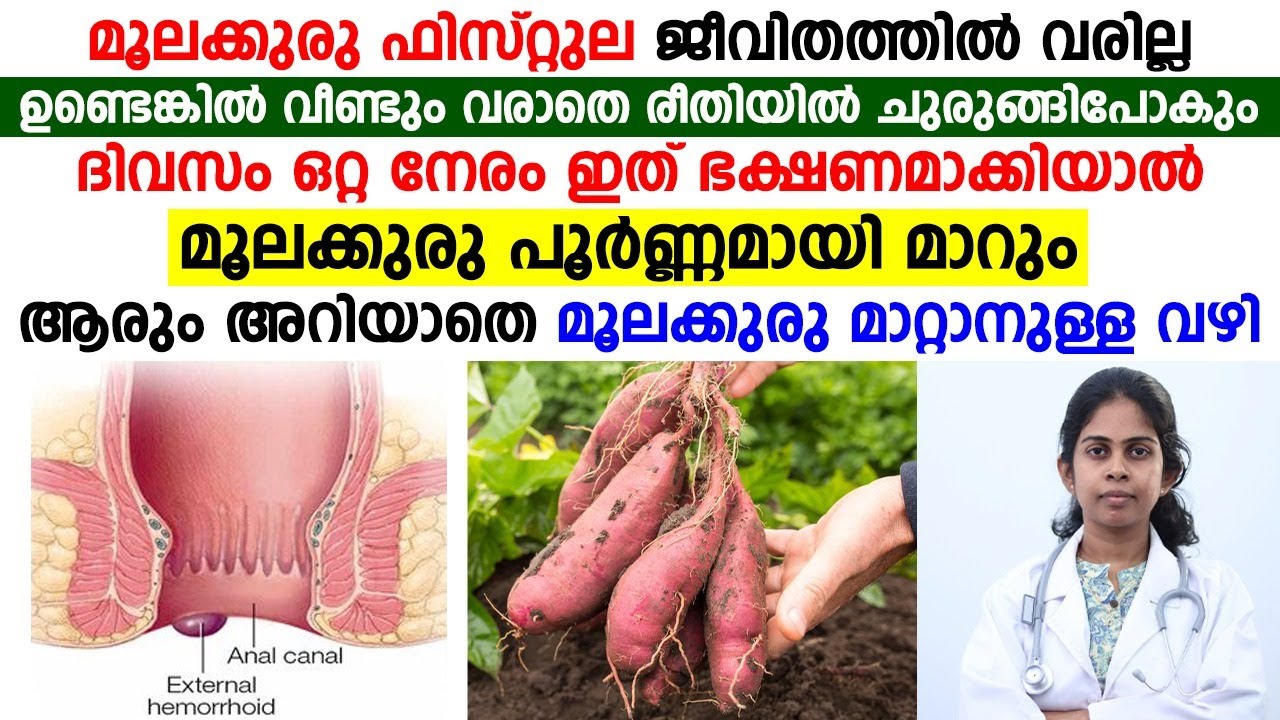 മൂലക്കുരു പൂർണമായി മാറ്റാം | വീട്ടിൽ നിന്ന് തന്നെ ഇങ്ങനെ ചെയ്താൽ അത് ...