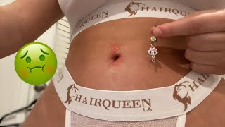 Belly Button Piercing Rejection Scar