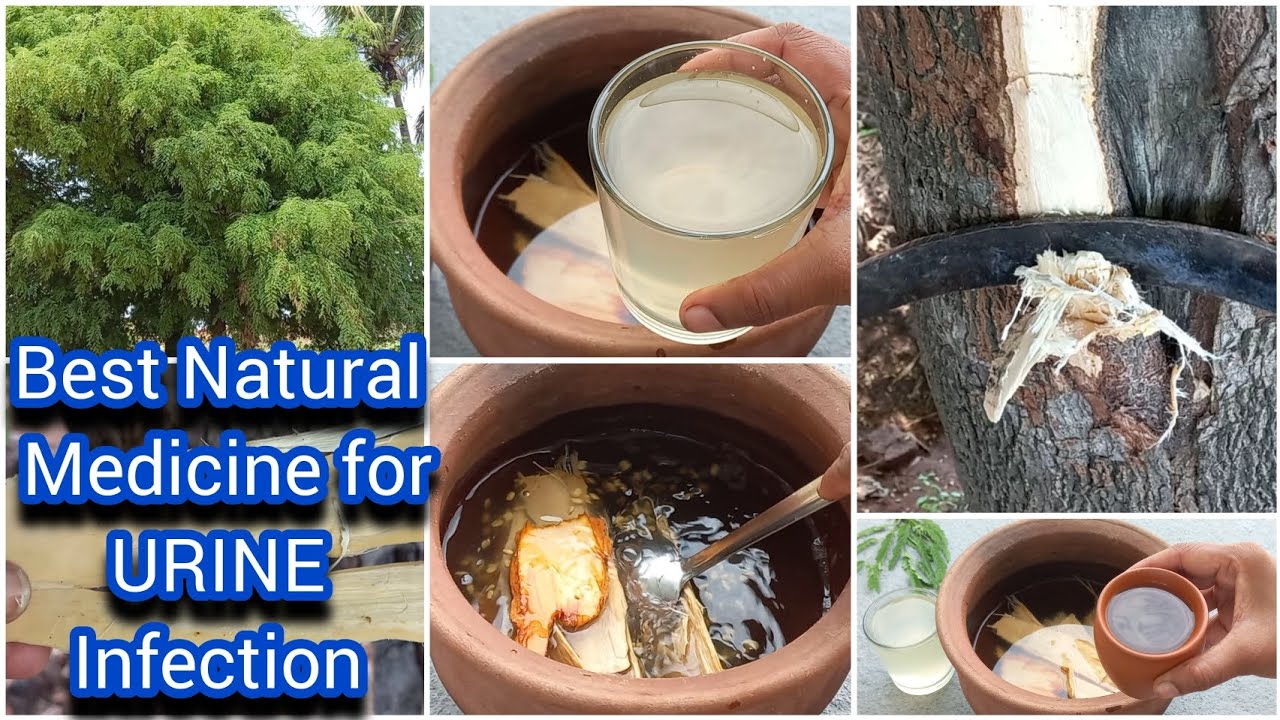 URINE Pass ಮಾಡುವಾಗ ಜಾಸ್ತಿ ಉರಿ ಇದ್ಯಾ ಹಾಗಾದ್ರೆ ಇದನ್ನು ತಪ್ಪದೆ Try ಮಾಡಿ ...